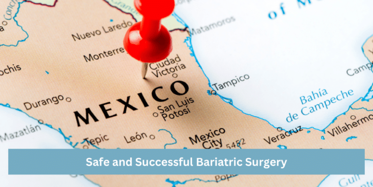 Safe Bariatric Surgery in Mexico: Tips for Safe, Successful Surgery