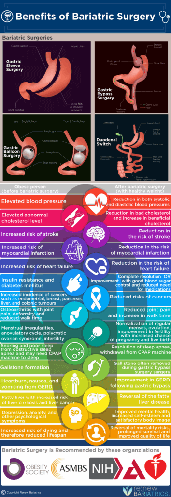 Health Benefits of Bariatric Surgery [Infographic] - Renew Bariatrics