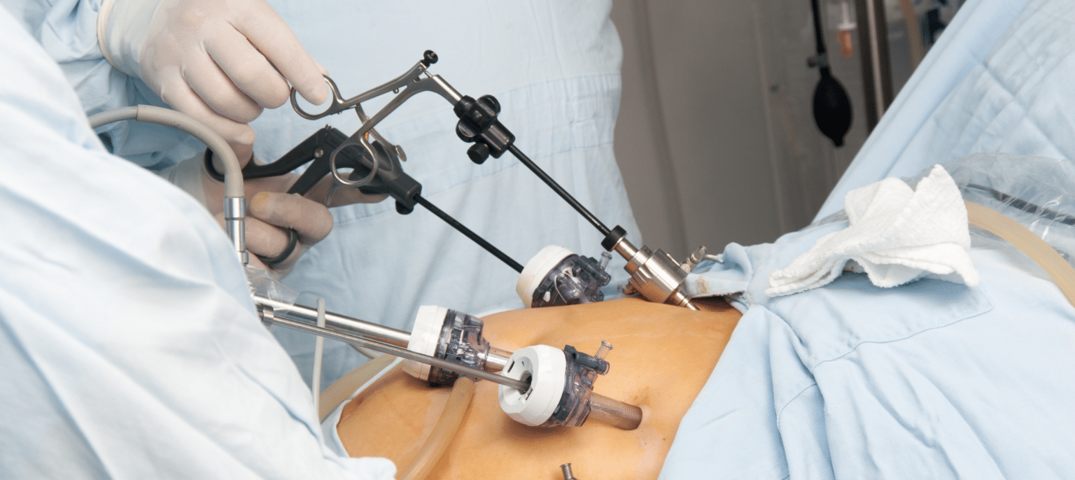 Gastric Bypass Reversal Statistics, Risks & Costs - Renew Bariatrics