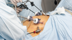 Malabsorptive vs Restrictive Bariatric Surgeries: Difference, Results