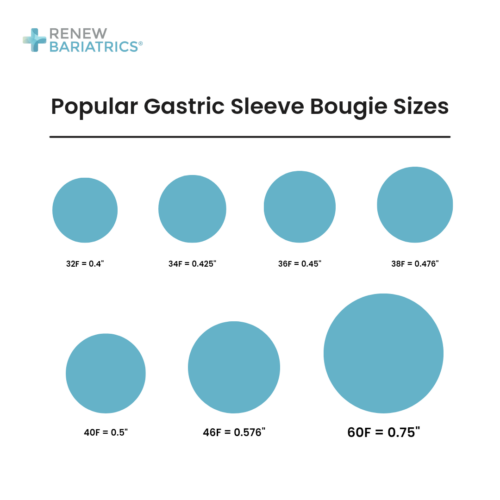 Gastric Sleeve Bougie: Optimal Size & What Is It - Renew Bariatrics