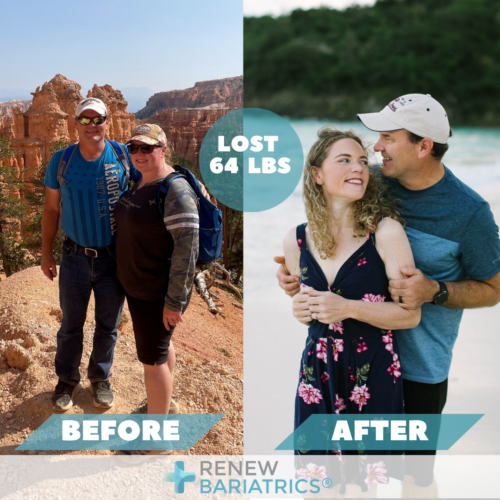 Gastric Sleeve Surgery in Tijuana, Mexico | Renew Bariatrics